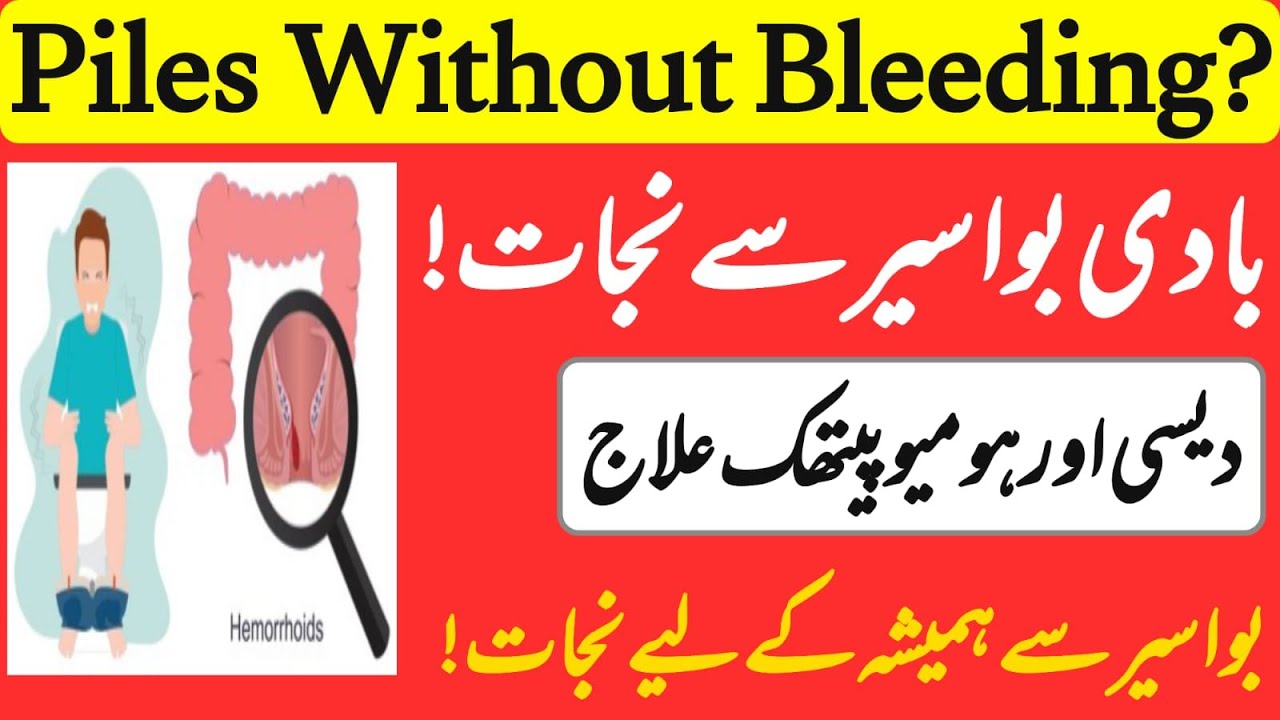 Piles Treatment | Non-Bleeding Hemorrhoids Causes, Symptoms & Best ...