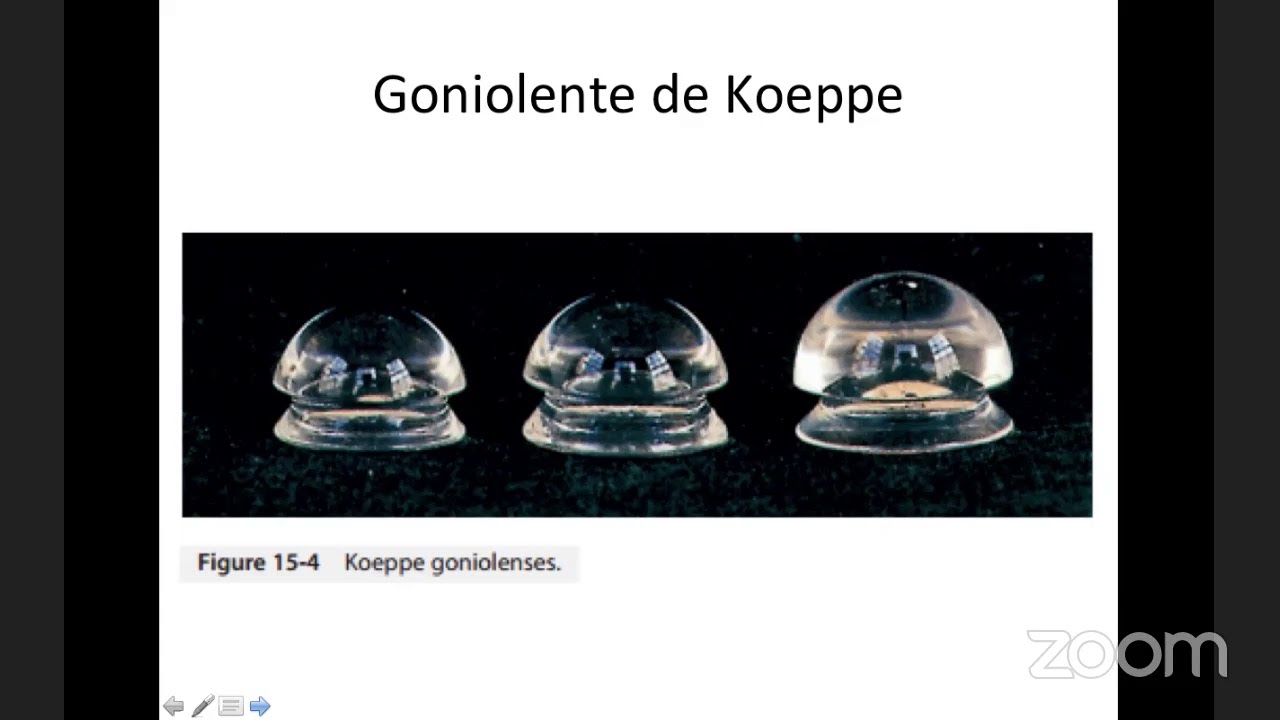 GLAUCOMA, Describe and understand basic principles of Goldmann ...