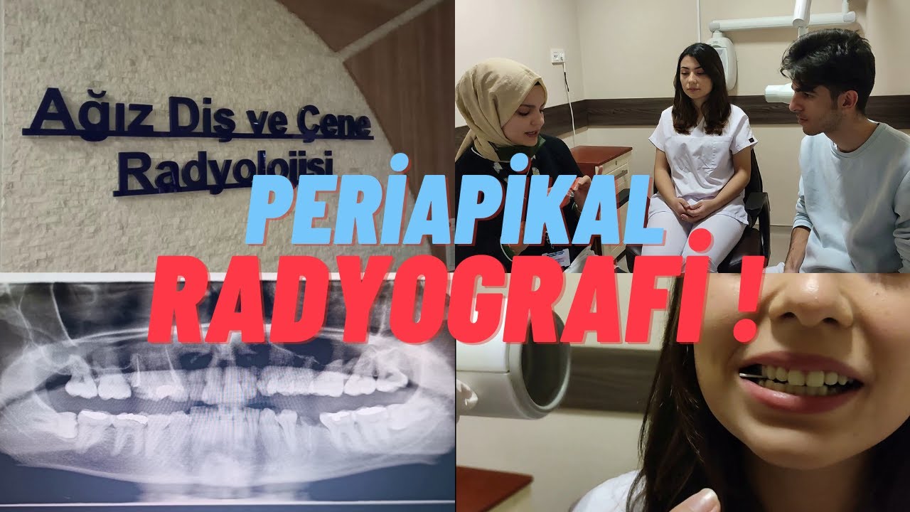 PERİAPİKAL FİLM NASIL ÇEKİLİR?/PERİAPİCAL RADİOGRAPHY/PANAROMİK FİLM ...