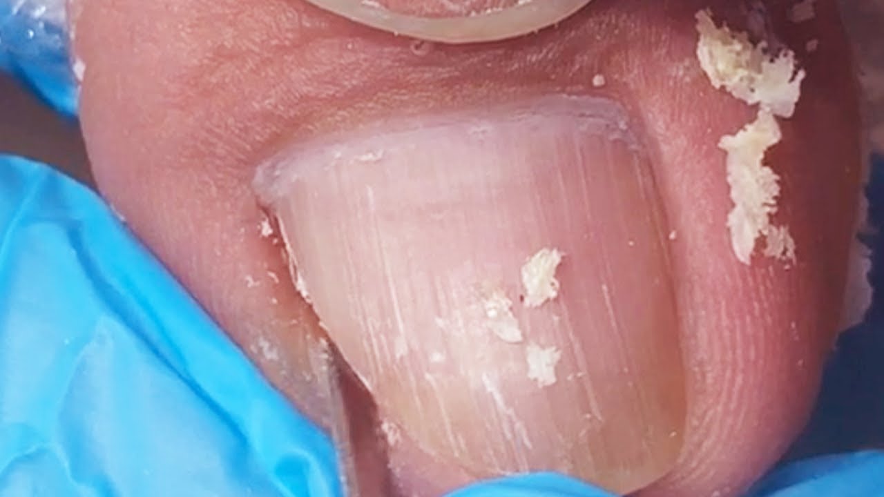 The seemingly clean toes are actually full of dead skin, the master ...