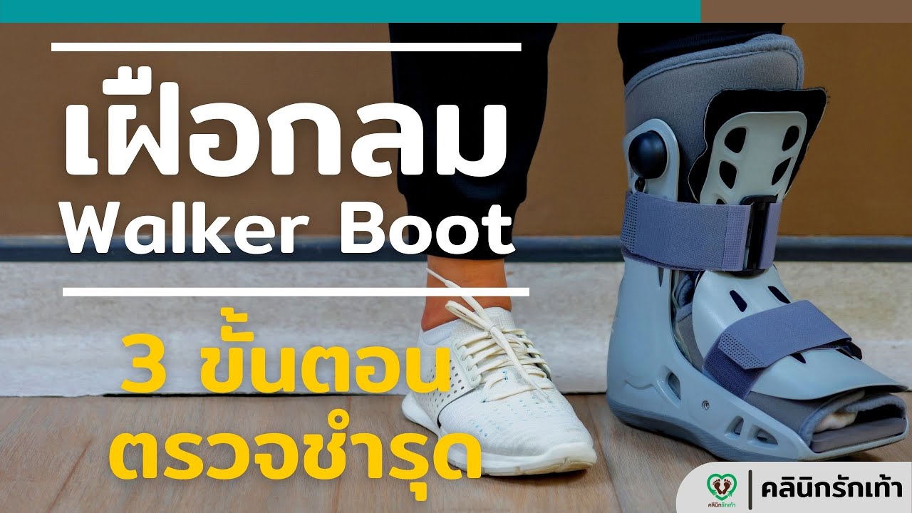วิธีการเช็คเฝือกลม หลังจากได้รับอุปกรณ์ ( How to Check Walker Boot ...