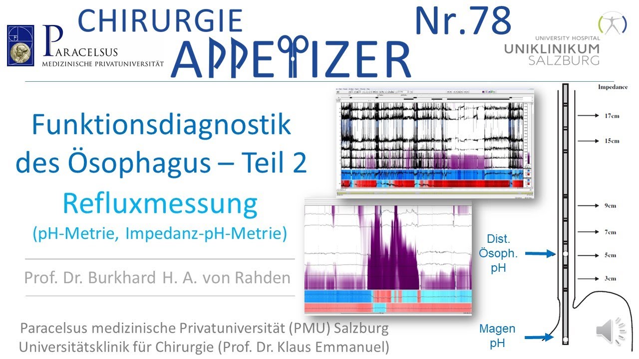 Funktionsdiagnostik II Refluxmessung pH-Metrie Impedanz-pH-Metrie ...