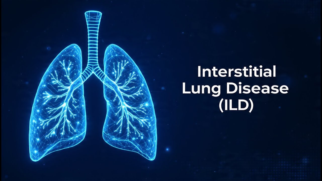 Interstitial Lung Disease (ILD) - Classification, pathophysiology ...