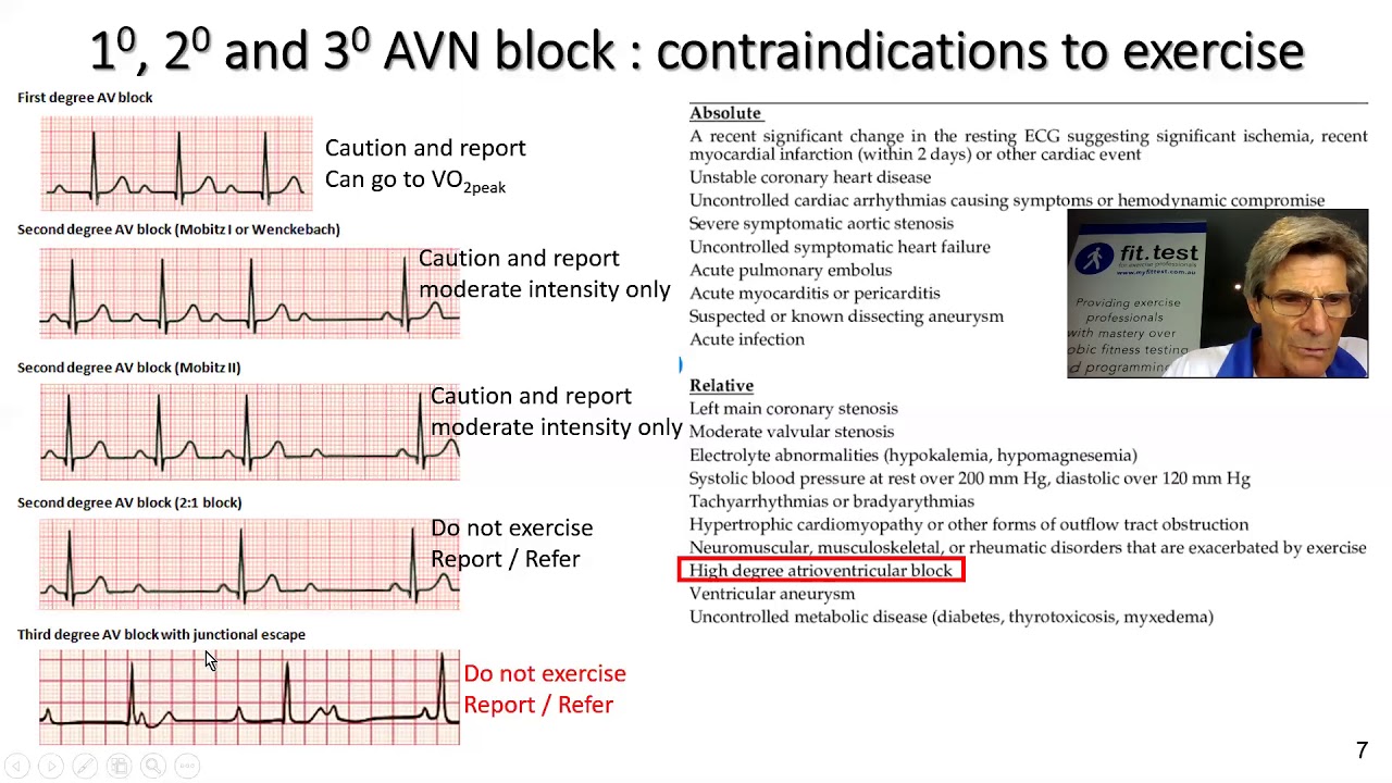 AVN blocks for exercise professionals: indications and ...