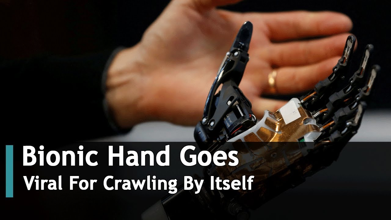 Bionic Hand Goes Viral For Crawling By Itself | DRM News Global | AI1T ...