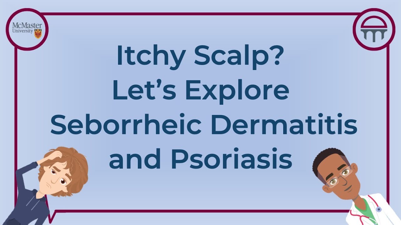 Seborrheic Dermatitis Scalp Treatment Nhs