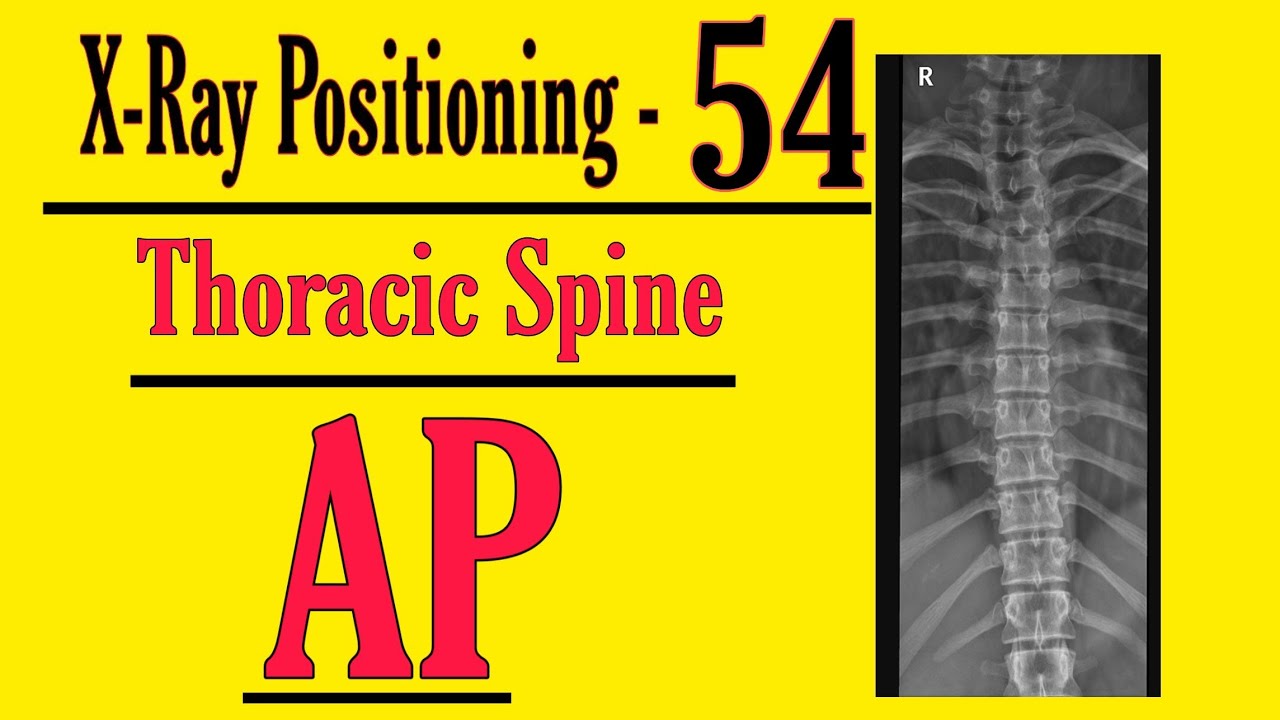 THORACIC SPINE AP PROJECTION HINDI | X RAY POSITIONING FOR ...