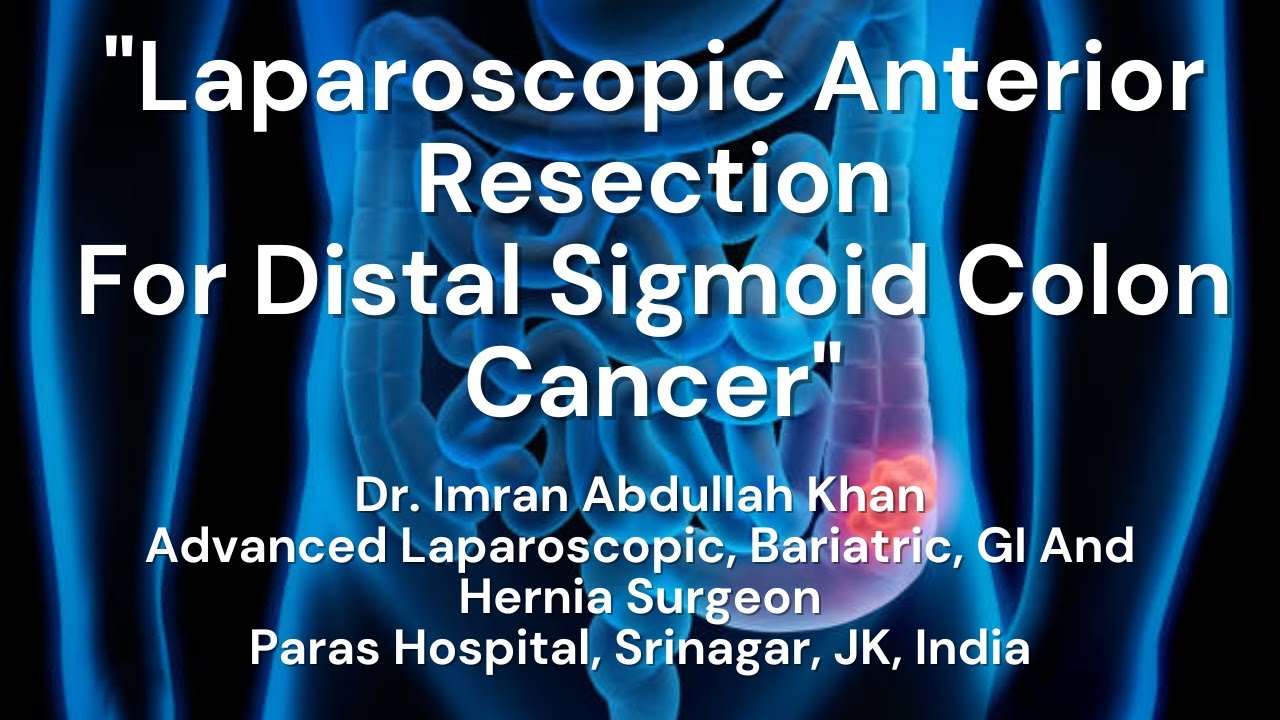 Laparoscopic Anterior Resection | Laparoscopic Cancer Surgery | Dr ...