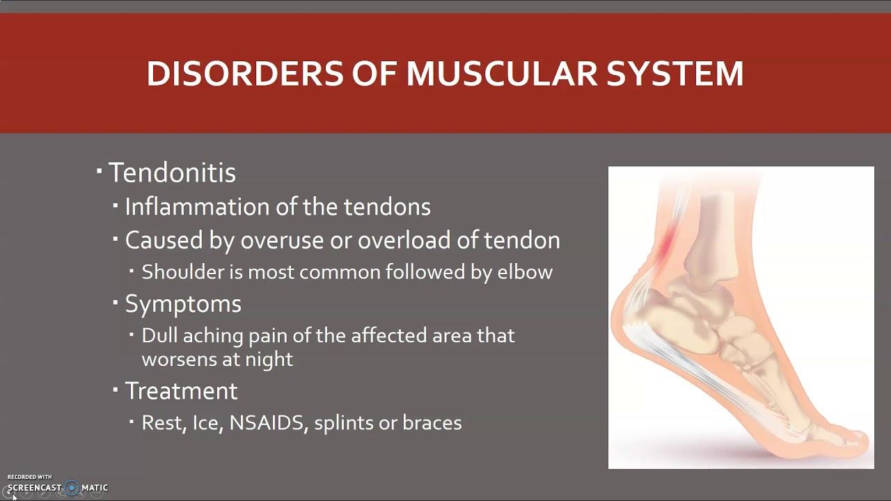 Muscular System - Part 5 - Disorders of the Musclar System - YouTube
