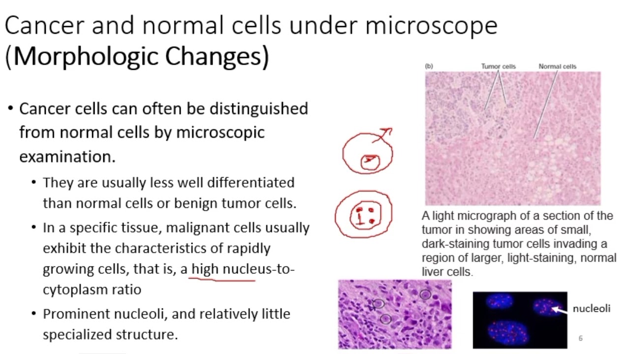 Cancer Biology Lecture 1 Part A - YouTube