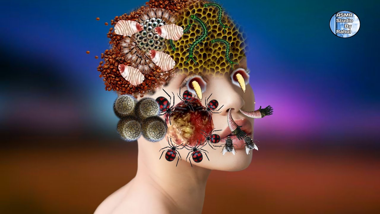 ASMR Remove Lady Face Worm Infected Severely Injured | Beauty Face ASMR ...