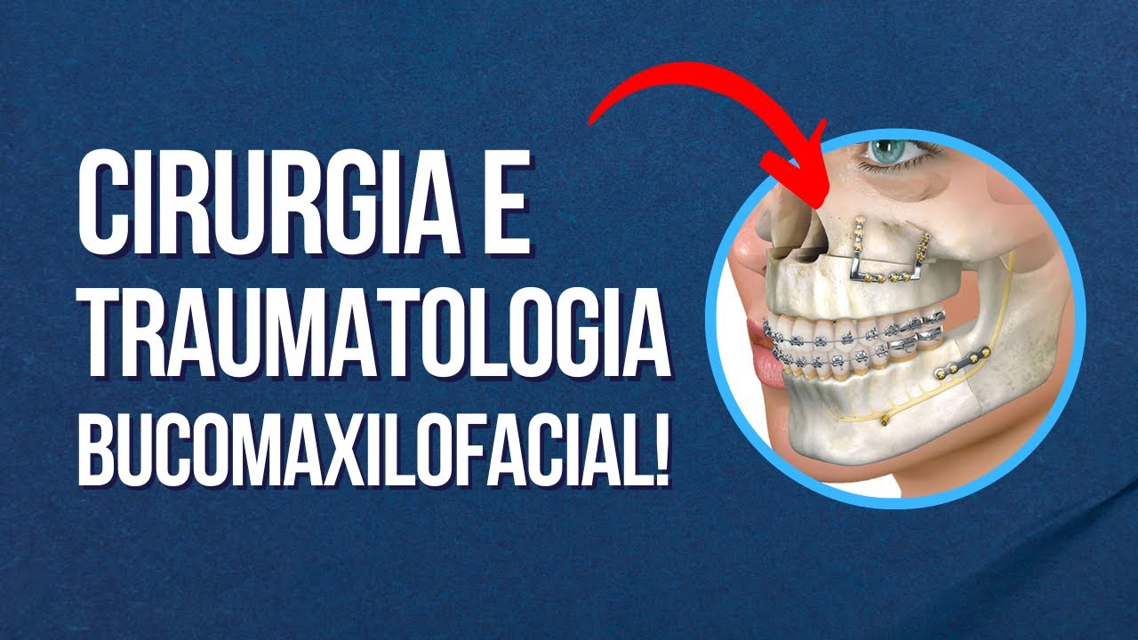Conhecendo a Cirurgia e Traumatologia Bucomaxilofacial - YouTube
