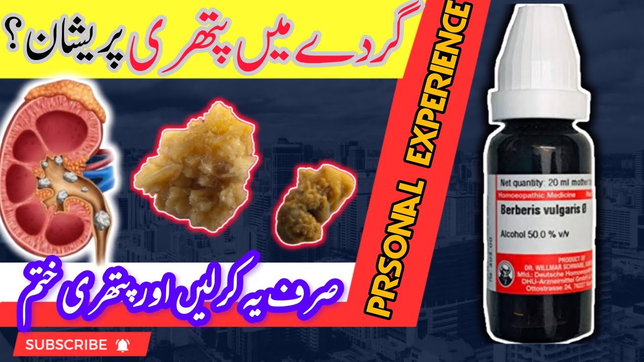 Kidney Stone problem | Tips and experience | Treatment of kidney stones ...