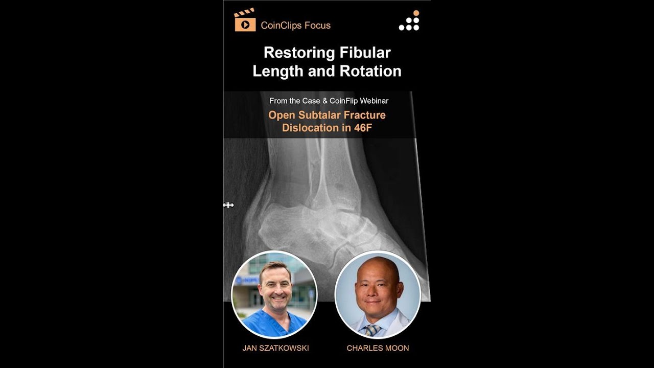 Restoring Fibular Length and Rotation - YouTube