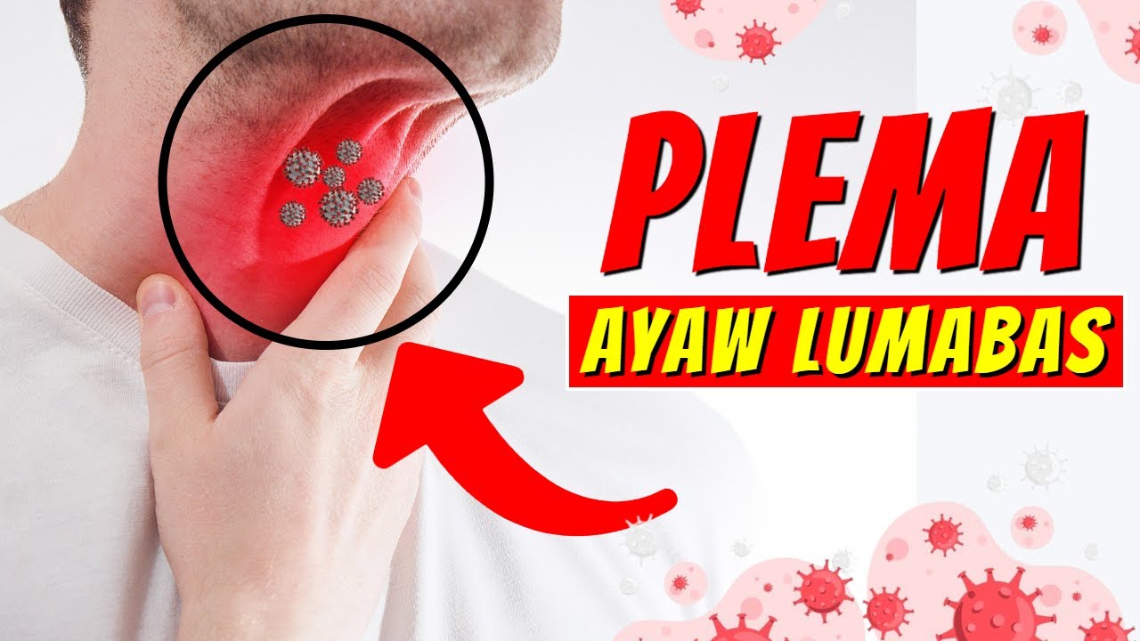 Home Remedies kapag may Plema Ka sa Baga na Ayaw Lumabas - YouTube