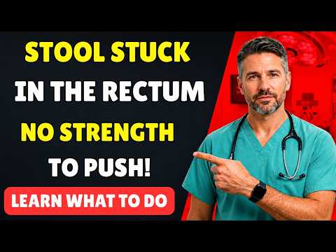 Stool Stuck in the Rectum? Doctor Explains What It Means & What to Do ⚠️🔥