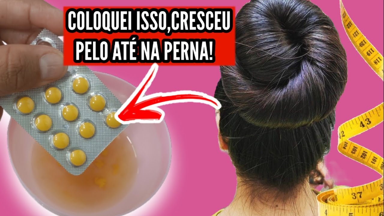 CABELO CRESCE RÁPIDO E NÃO CAI, MELHOR FORMA DE CRESCIMENTO DO MUNDO ...