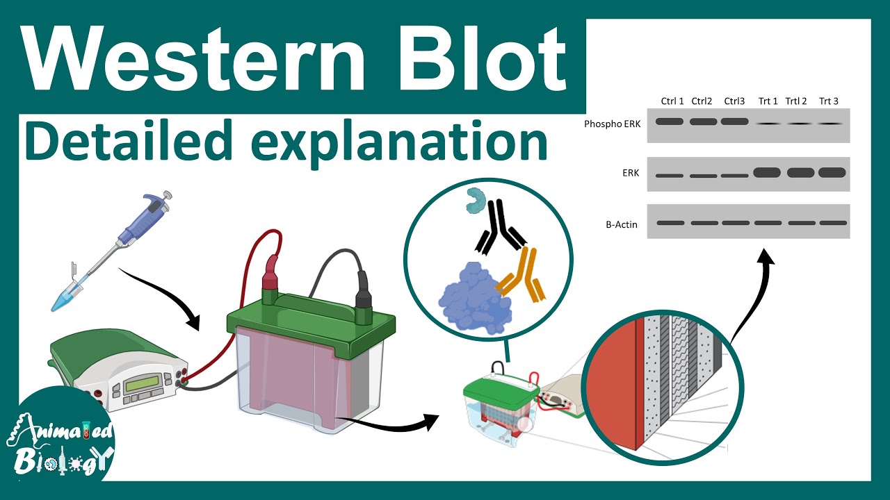 Western blot explained in details | Applications of western blot | CSIR ...