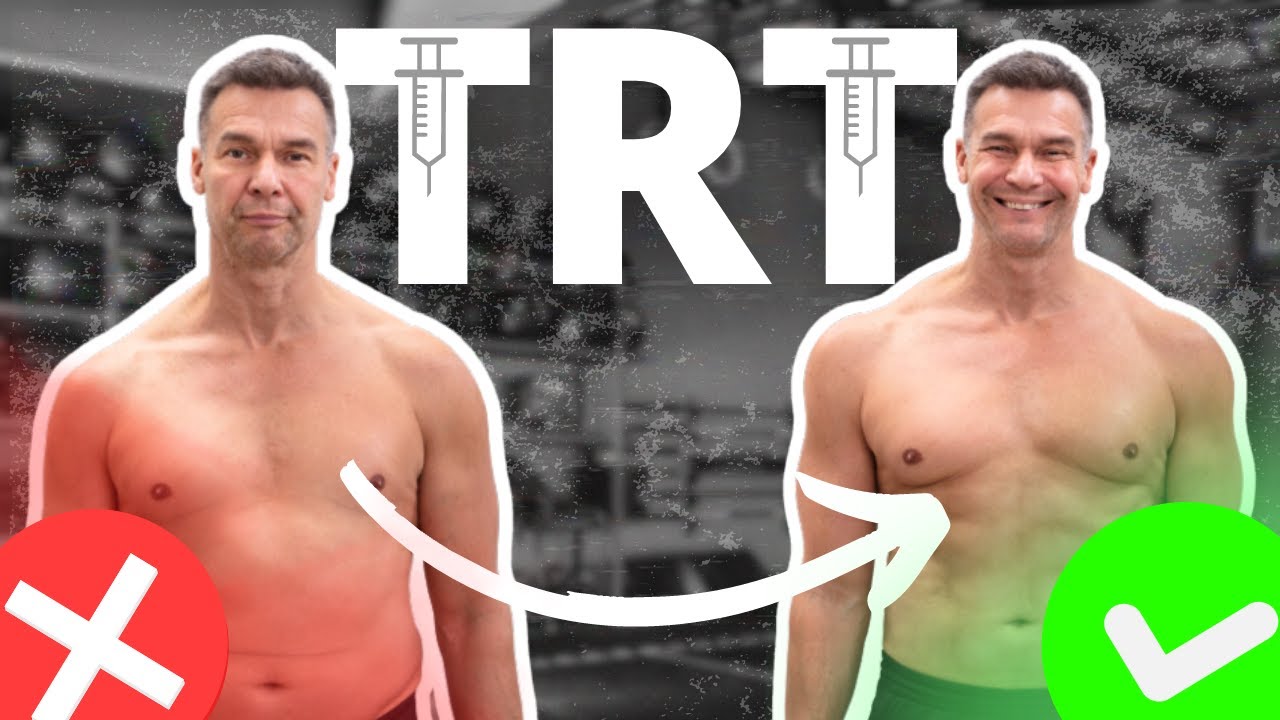 Substituční Terapie Testosteronem (TRT) - YouTube