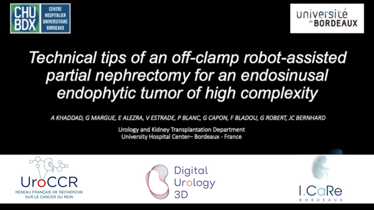 Technical tips: an off-clamp robot-assisted partial nephrectomy for an ...