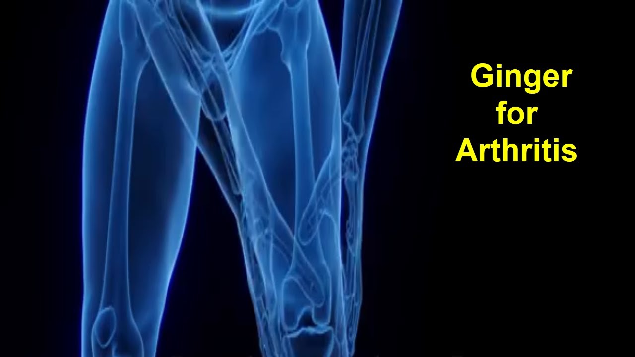 Can Ginger and Ginger oil help people with Arthritis ( joint pain)? try ...