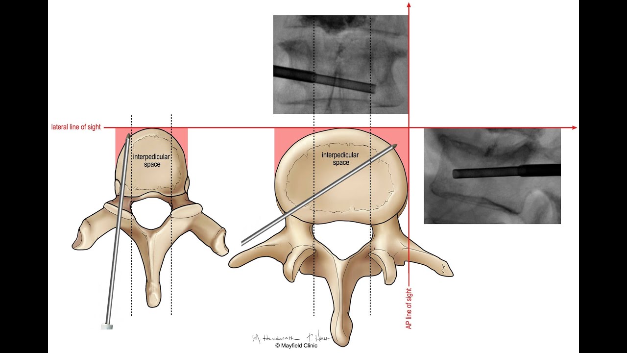 Video 6. Danger zones - YouTube