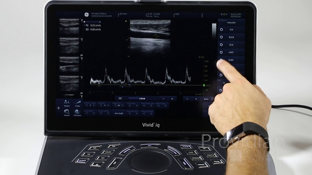 GE Vivid iq Training Part 3: Measurements and Annotations - YouTube