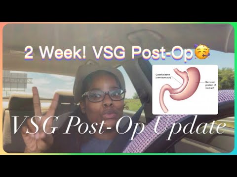 VSG Surgery | Two week post-op bariatric surgery (Update) - YouTube