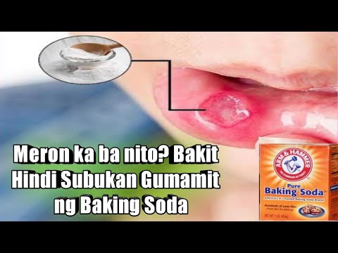 Gamitin Ang Baking Soda Sa Paraang Ito,At Magugulat sa Resulta, Iba't ...
