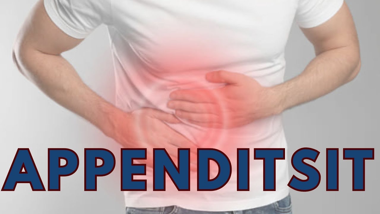 Appenditsit , etiopatogenez, klinika, diagnostika va davolash. # ...