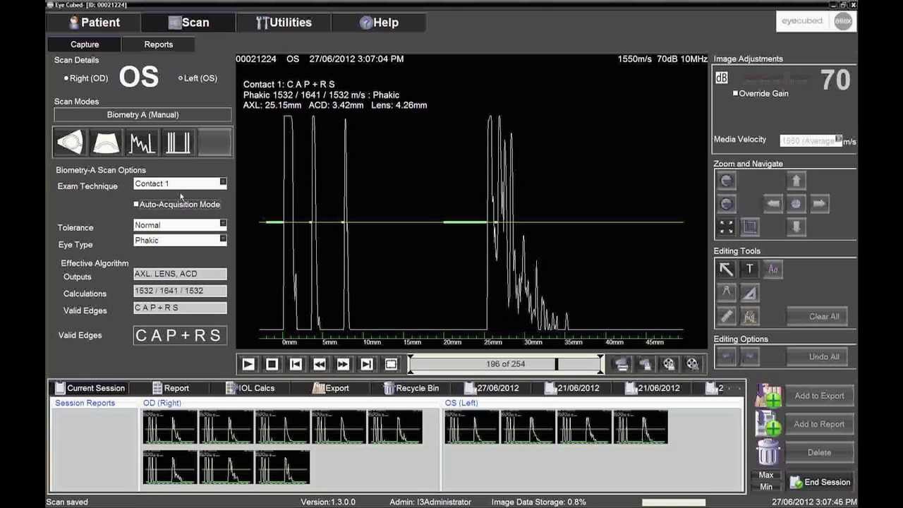 Performing Contact Biometry with the Ellex Eye Cubed - YouTube