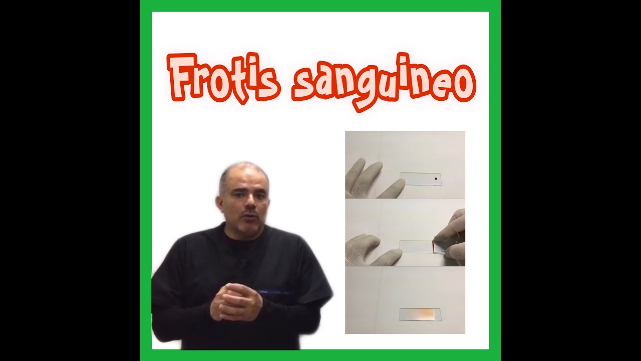 Como realizar un frotis sanguíneo para principiantes - YouTube