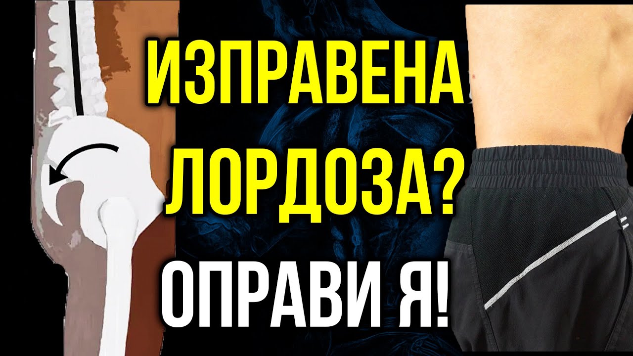 Изправена ЛОРДОЗА 5 упражнения за ИЗГЛАДЕНА ЛОРДОЗА Youtube
