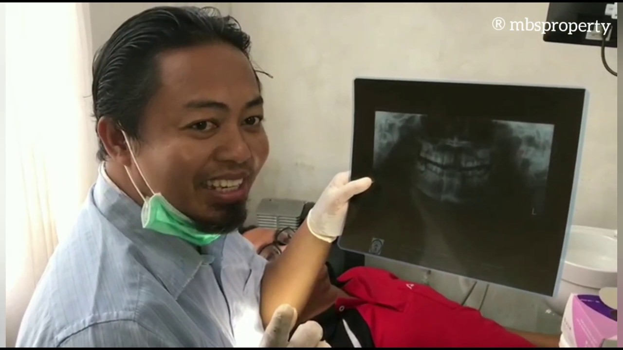 Geraham Bungsu Apakah Bisa Dikerjakan di Puskesmas dan Perlu Ronsen ...