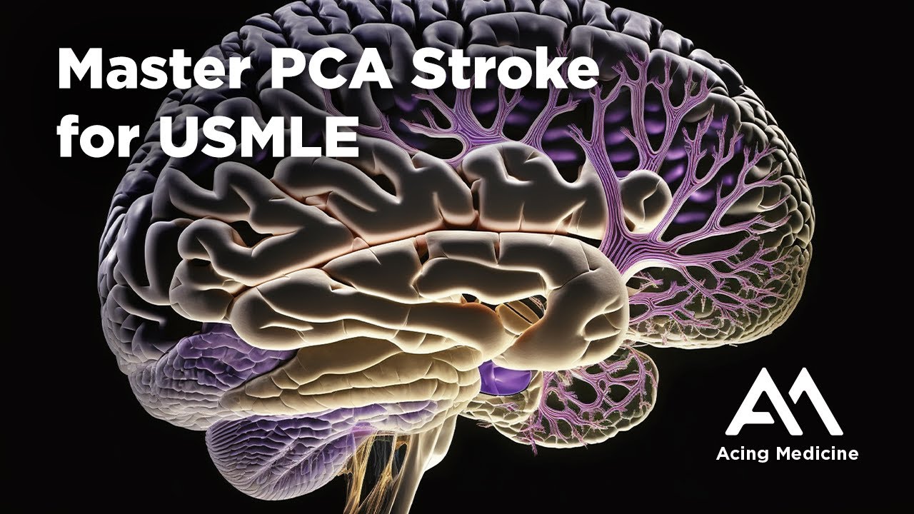 Master PCA Stroke for USMLE | Key Concepts & High-Yield Facts by Acing ...