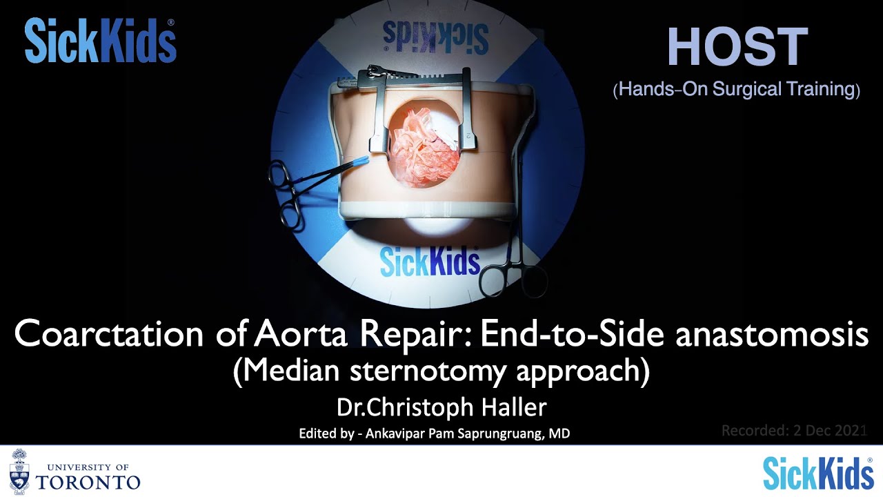 Coarctation of Aorta Repair: End-to-Side anastomosis (Median sternotomy ...
