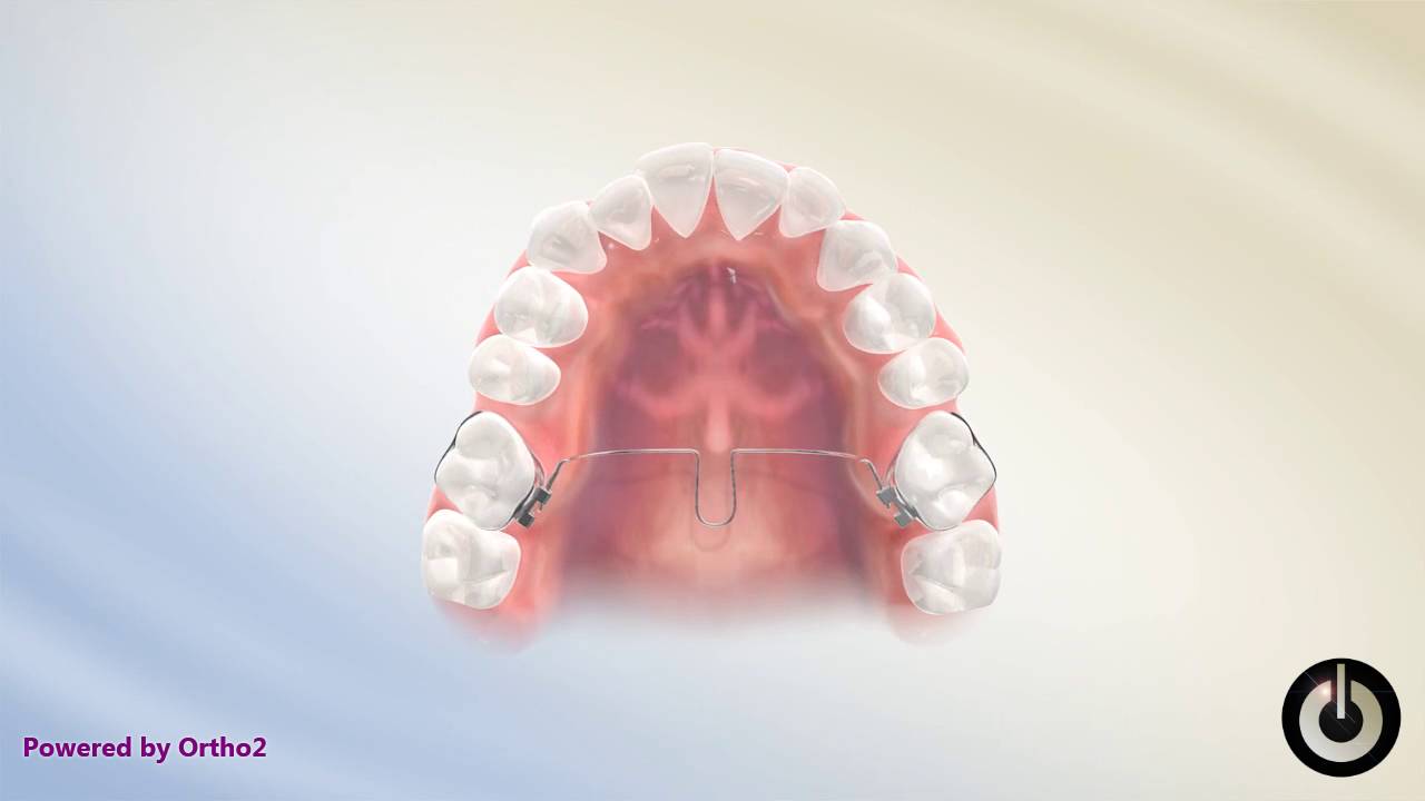 Cetlin Mechanics - YouTube