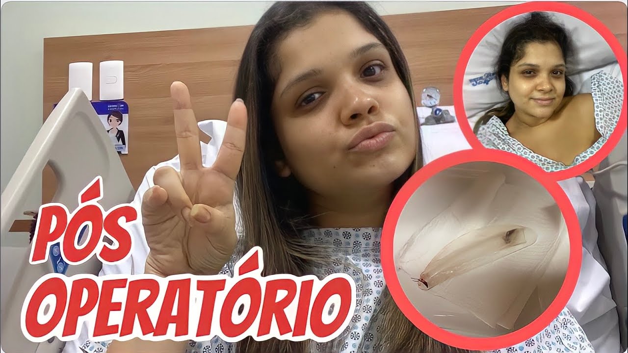 TUDO SOBRE UM PÓS OPERATÓRIO DE SEPTOPLASTIA E TURBINECTOMIA ...