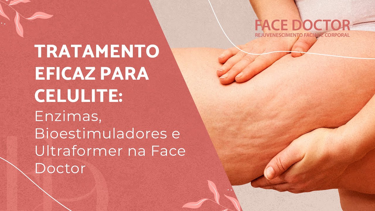 Tratamento Eficaz para Celulite: Enzimas, Bioestimuladores e ...