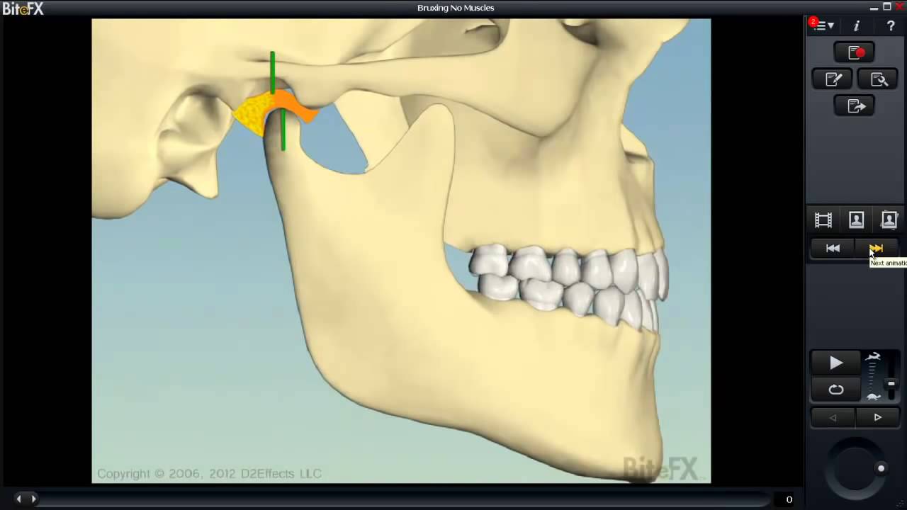 Relaxation Splint - YouTube