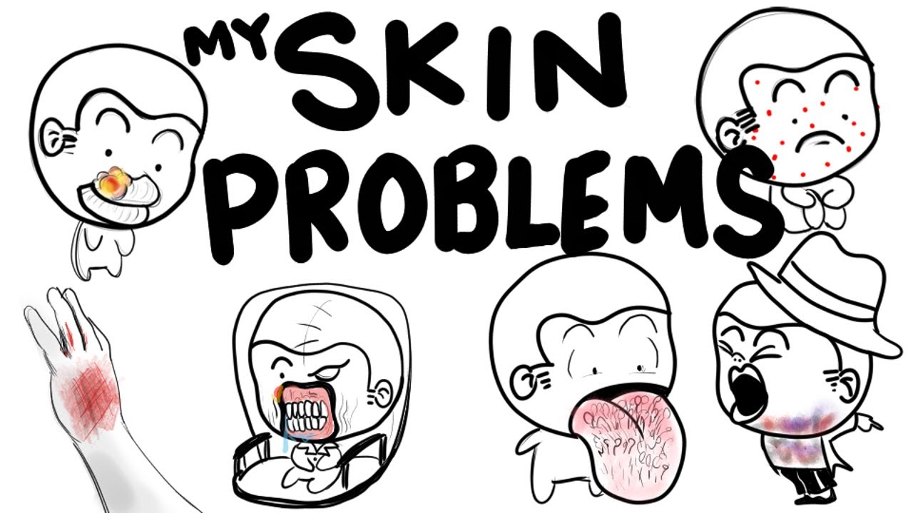 My Skin Problems! (animated story) - YouTube