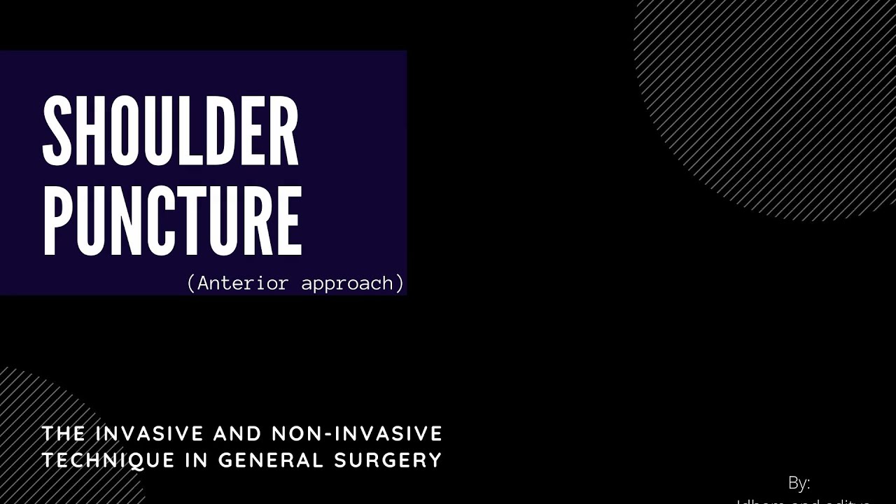 Shoulder Puncture (anterior) - Invasive and Non-invasive Technique in ...