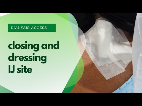 How to close and dress IJ catheter properly post dialysis - YouTube