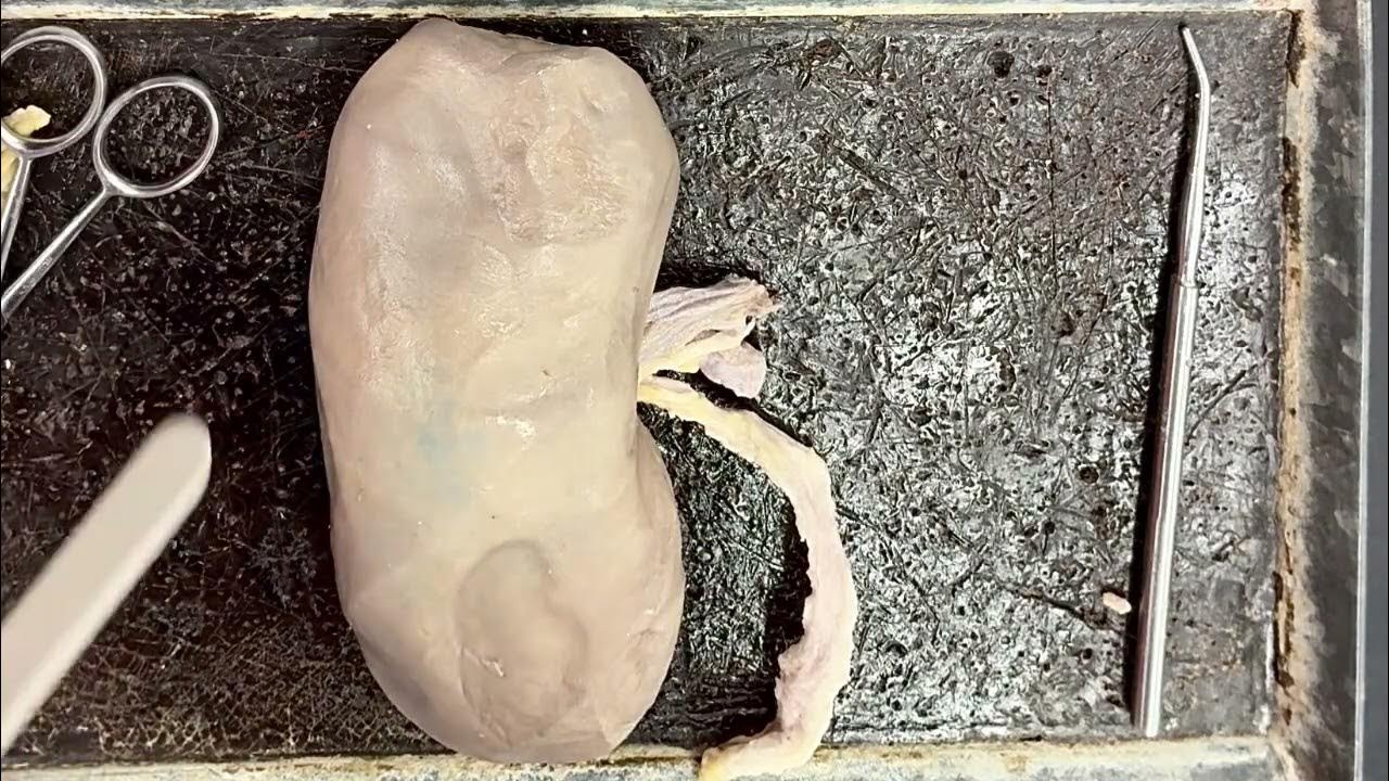 Pig Kidney Dissection - YouTube