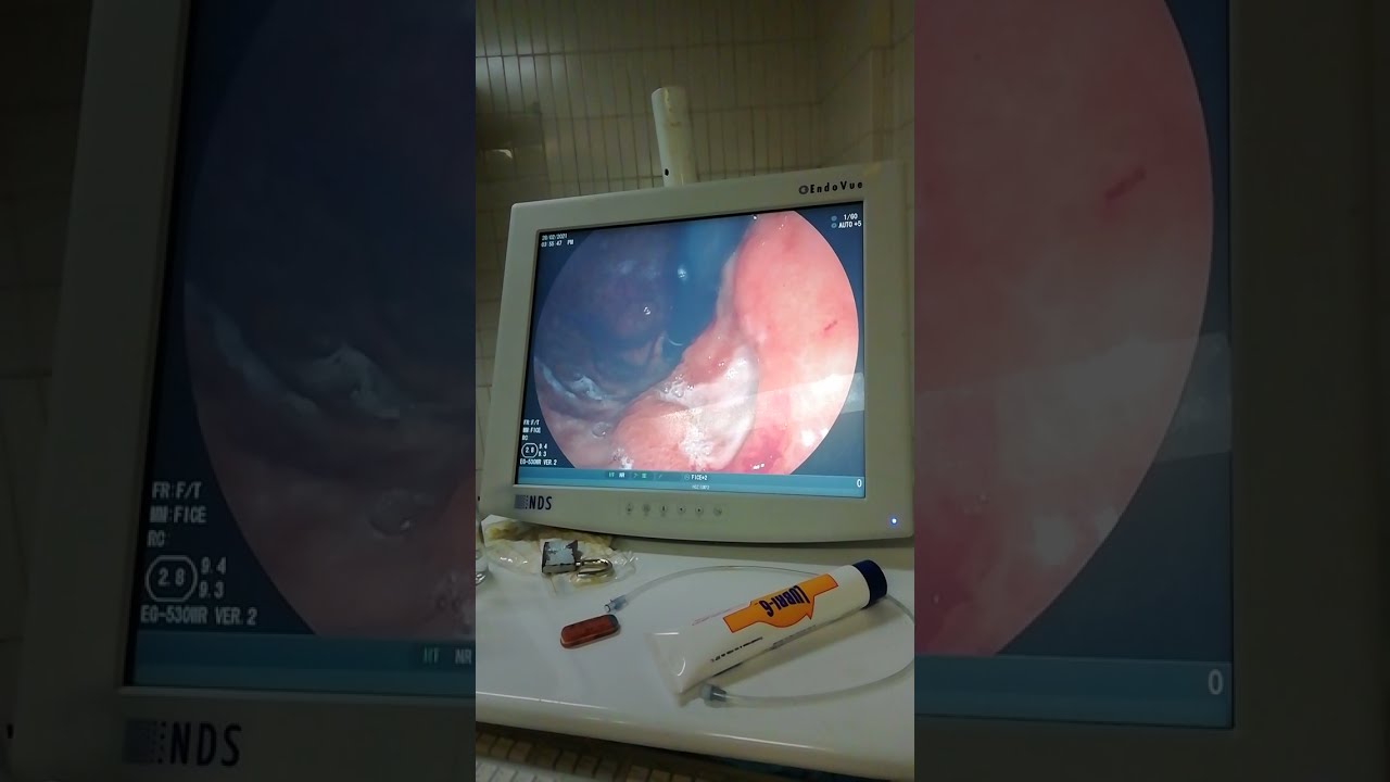 Borrmann Iii Tem Cura - RETOEDU