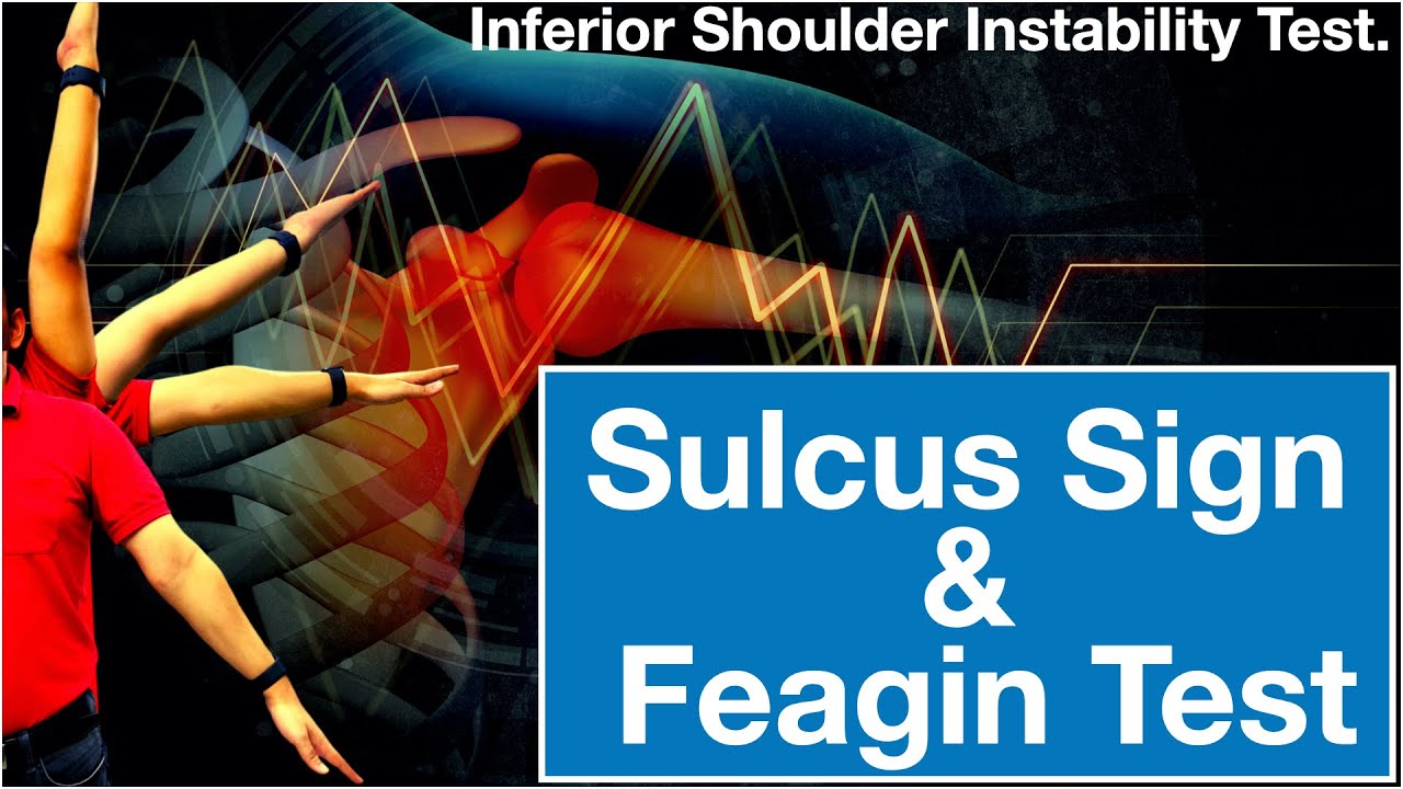 Sulcus Sign & Feagin Test. - YouTube