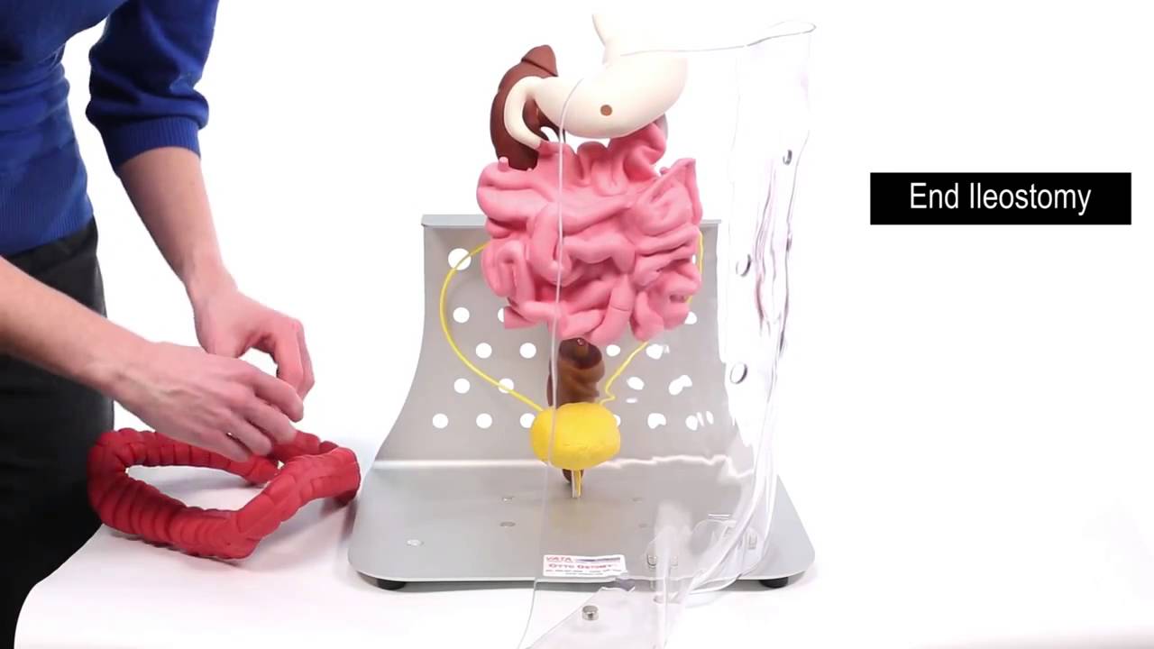 Otto Ostomy™ Model Advanced - YouTube