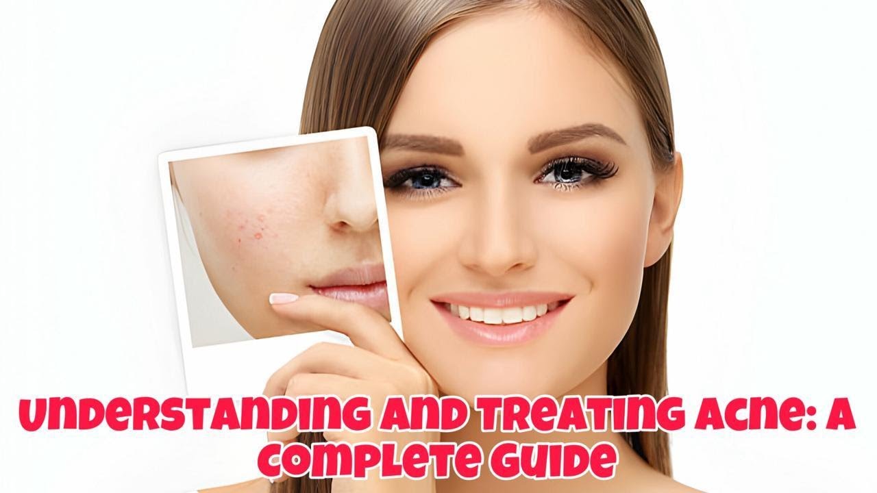 Understanding and Treating Acne A Complete Guide - YouTube