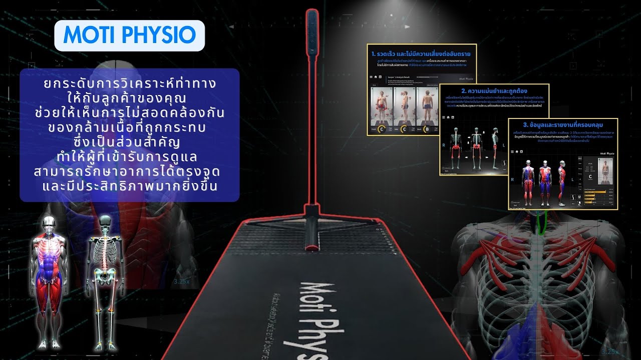 Moti Physio 3D - เครื่องวิเคราะห์ท่าทาง AI แบบ 3 มิติ สามารถเห็นการไม่ ...