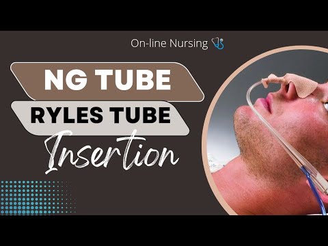 NG TUBE /RYLES TUBE/ NASOGASTRIC TUBE || FUNDAMENTAL OF NURSING|| - YouTube